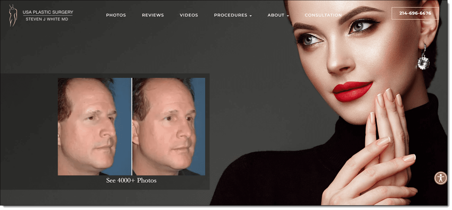 Meet Dr. Steven J. White of USA Plastic Surgery in Dallas, Texas ...
